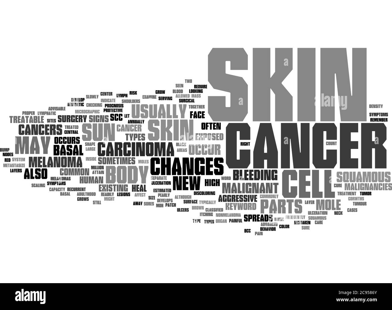 Types Of Skin Cancer High Resolution Stock Photography and Images - Alamy
