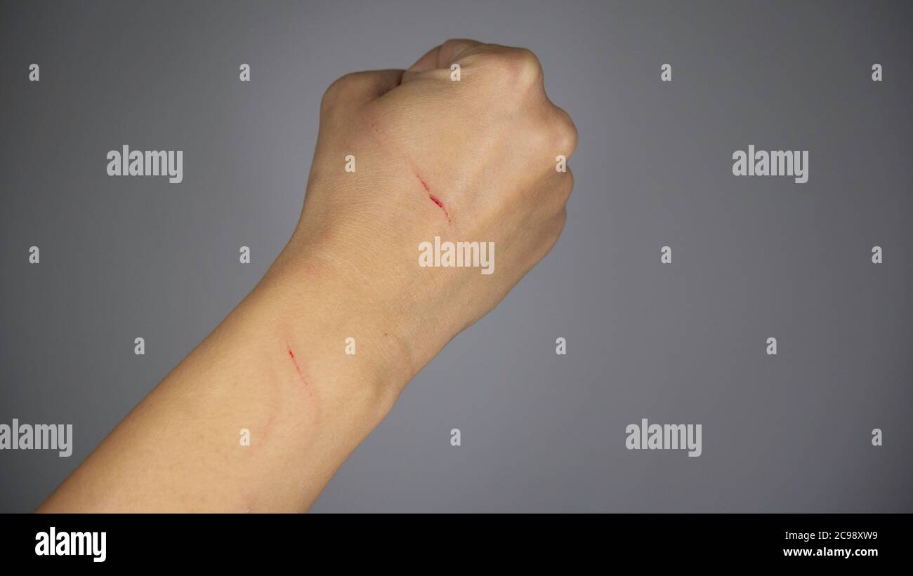 A woman's hand in a fist scratched by a cat on a gray background Stock ...