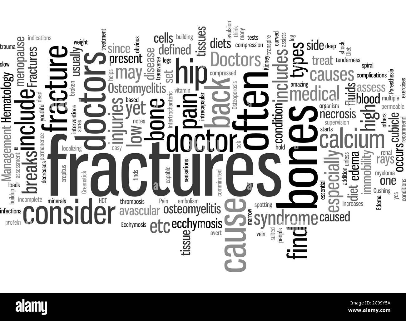 Types Of Fractures Of Bones High Resolution Stock Photography and ...