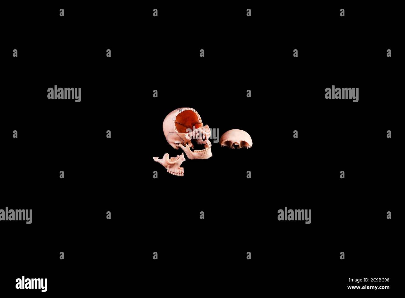 Human jaw bone hi-res stock photography and images - Alamy