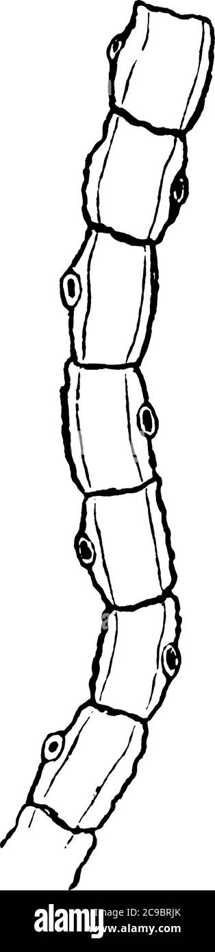 Tapeworms are flat, segmented worms that live in the intestines of some ...