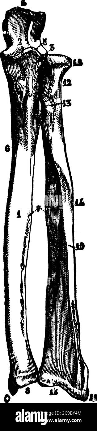 The Ulna is the medial bone of forearm that stretches from the elbow to ...