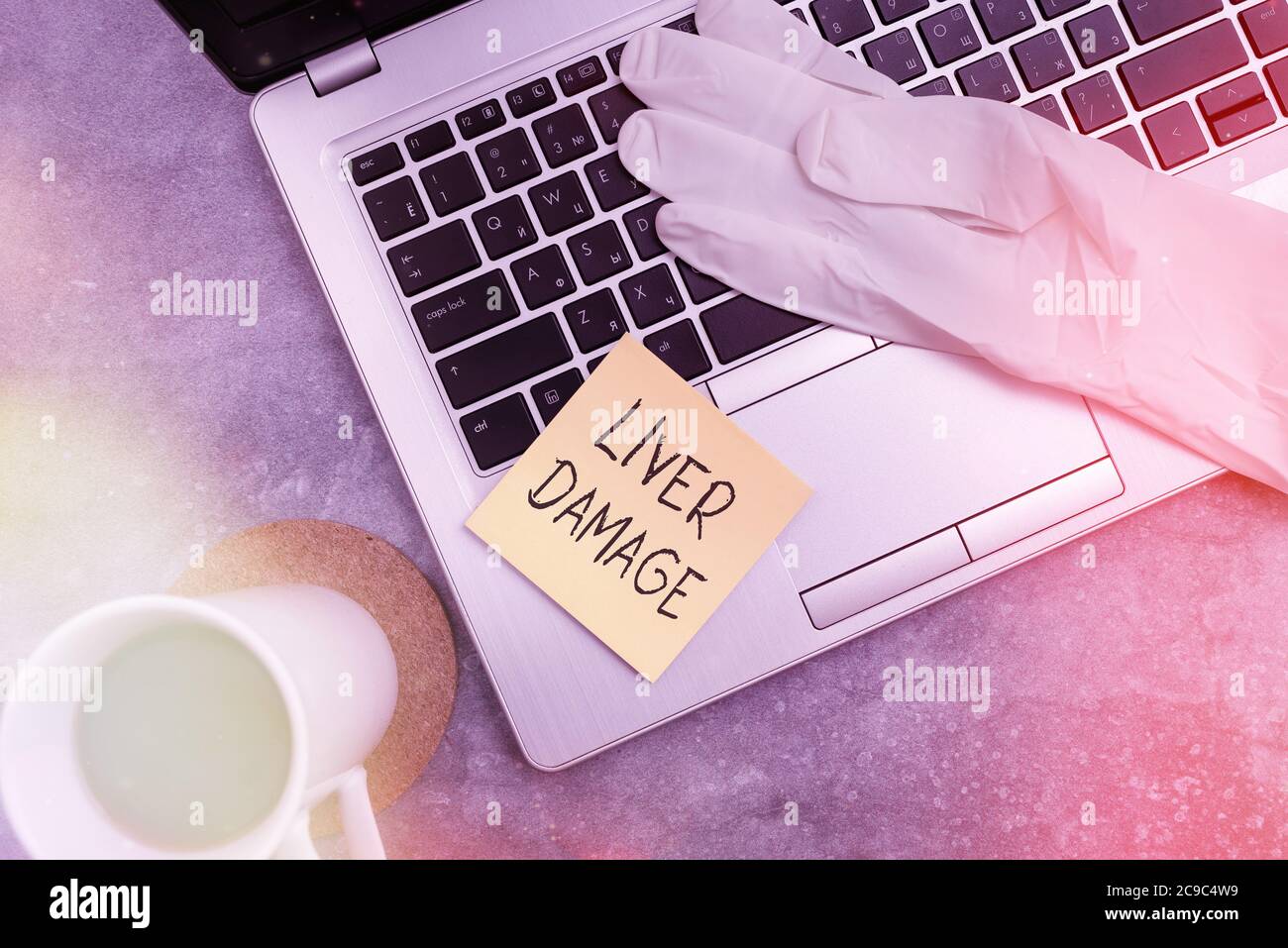 Conceptual hand writing showing Liver Damage. Concept meaning any ...