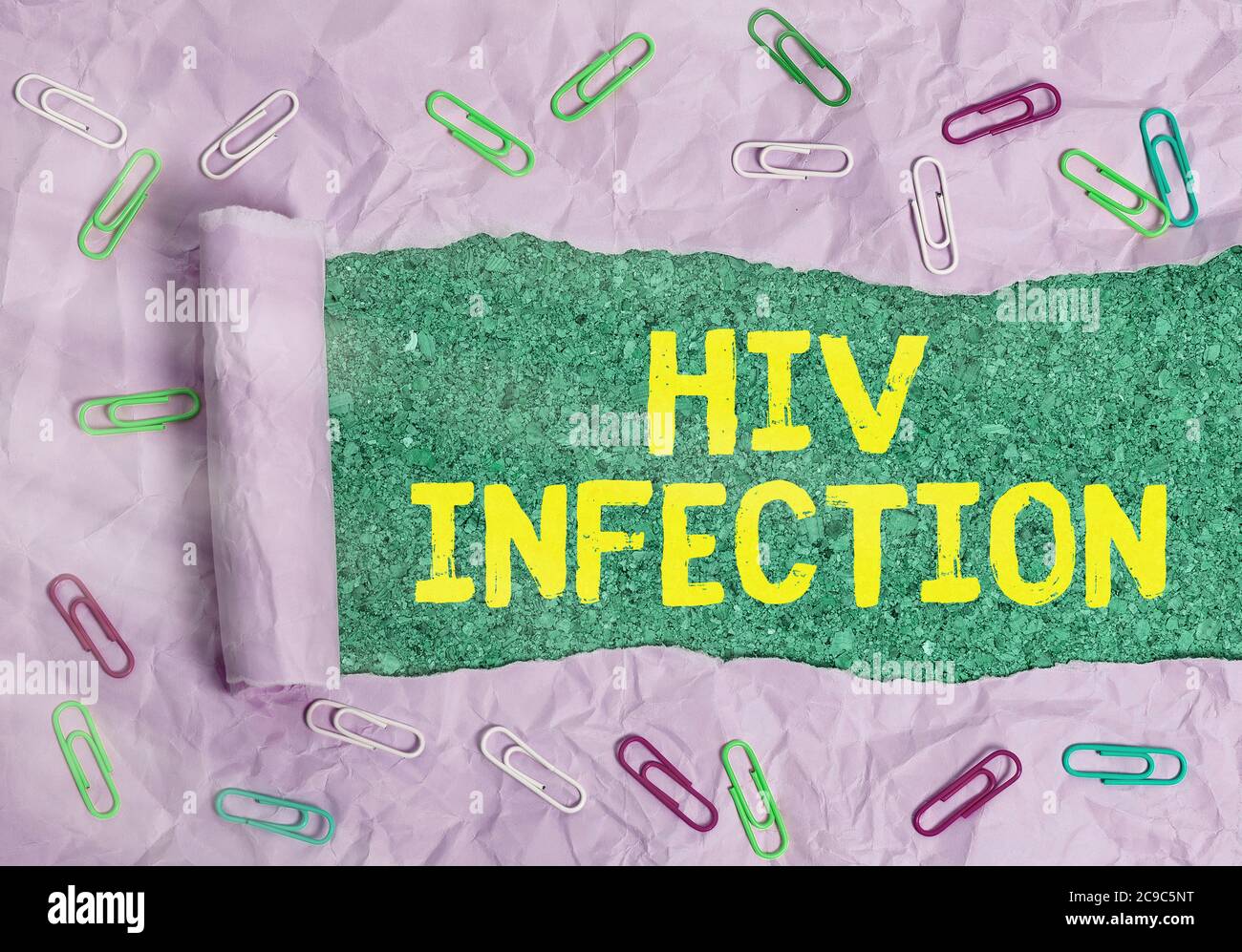 Word writing text Hiv Infection. Business photo showcasing A disease of ...