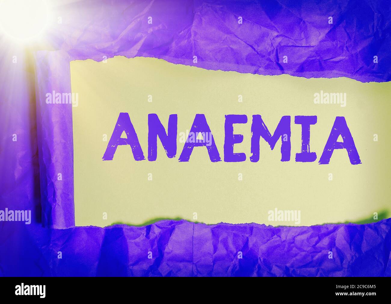 Handwriting text writing Anaemia. Conceptual photo a condition marked ...