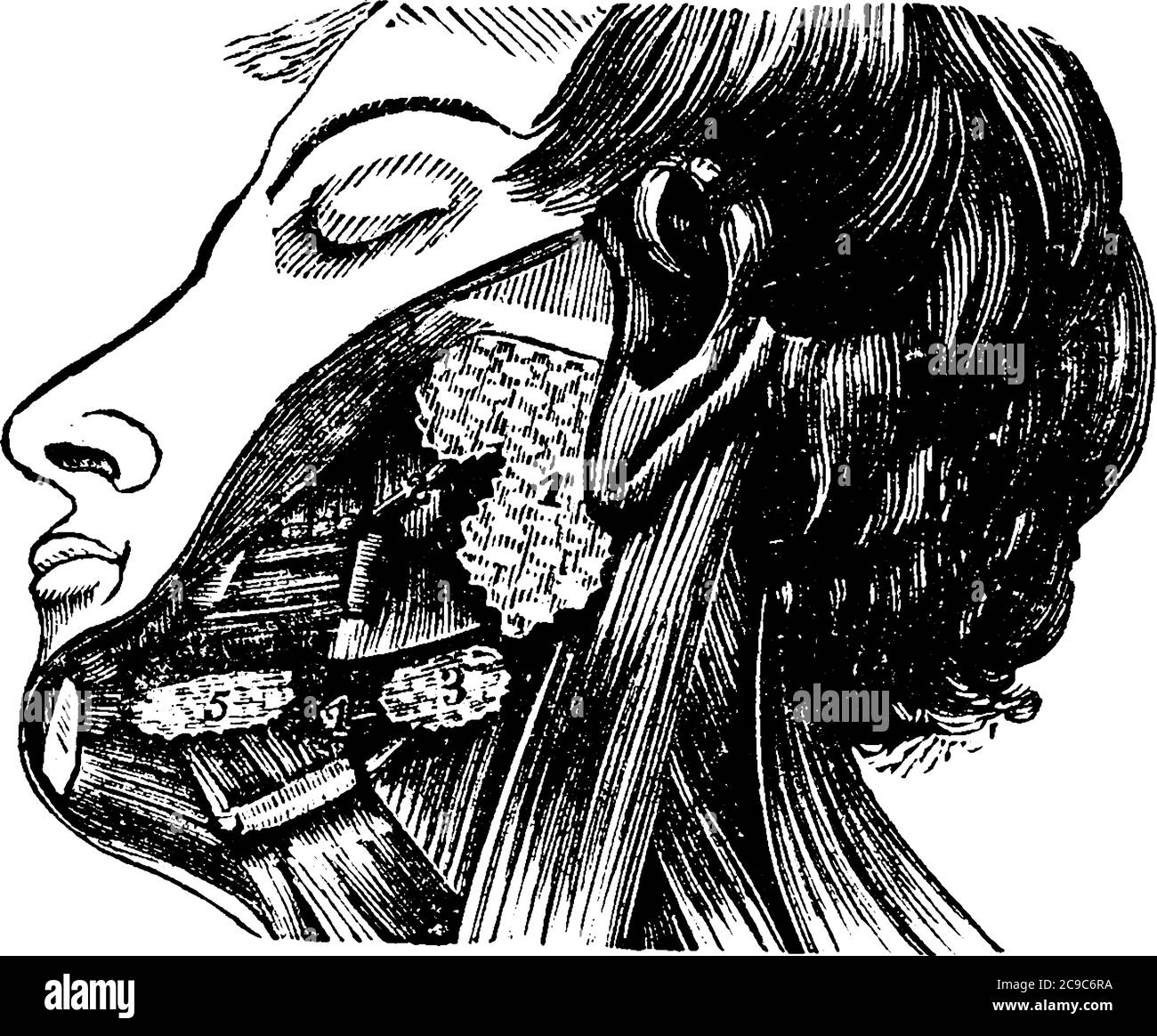 Parotid salivary gland Black and White Stock Photos & Images - Alamy