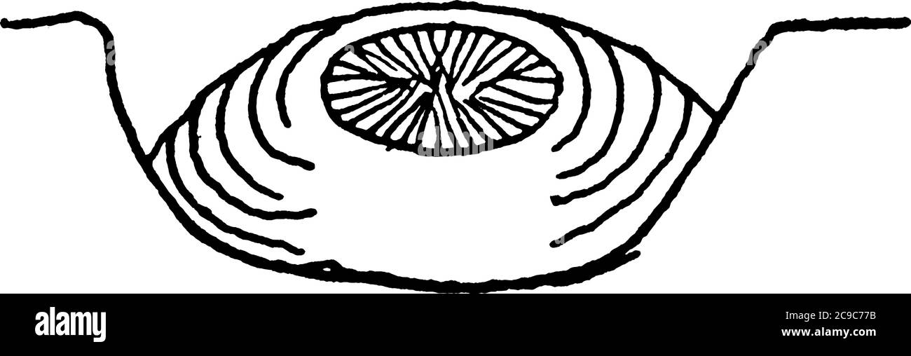 Insect Exoskeleton Sketch