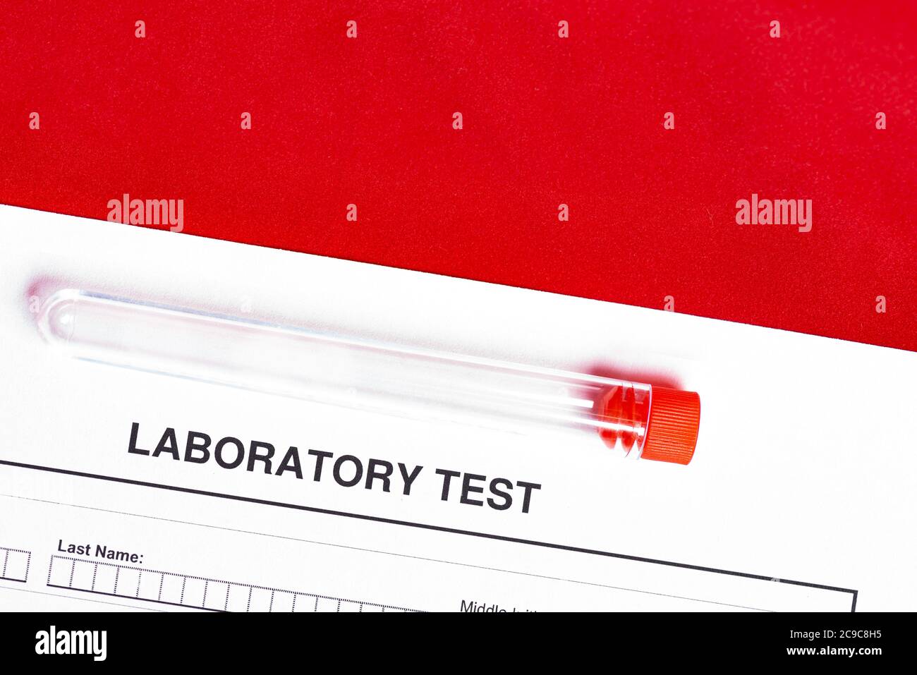 Form to fill in with results of empty test in tube red background Stock ...