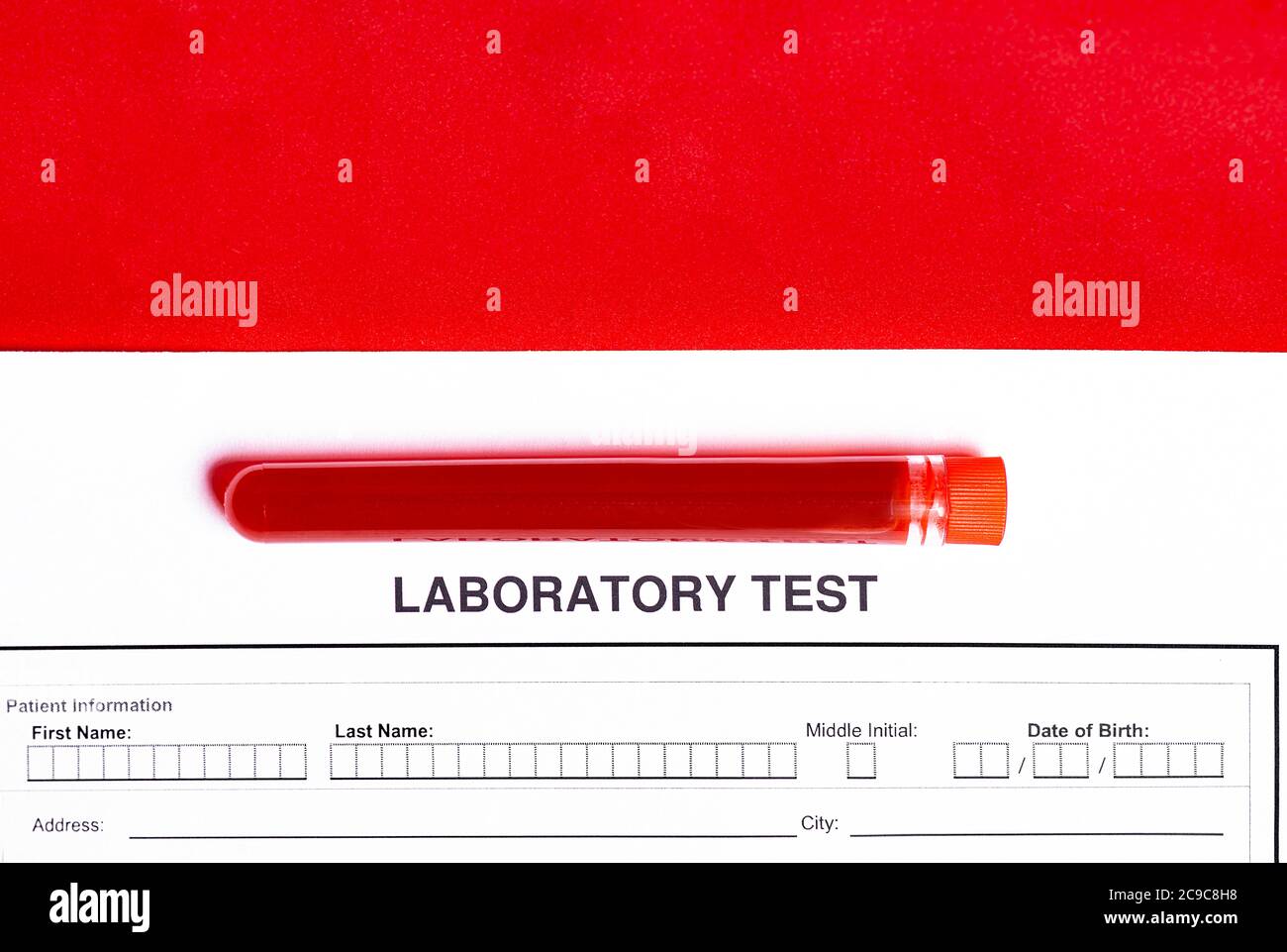 Blood test paper hi-res stock photography and images - Alamy
