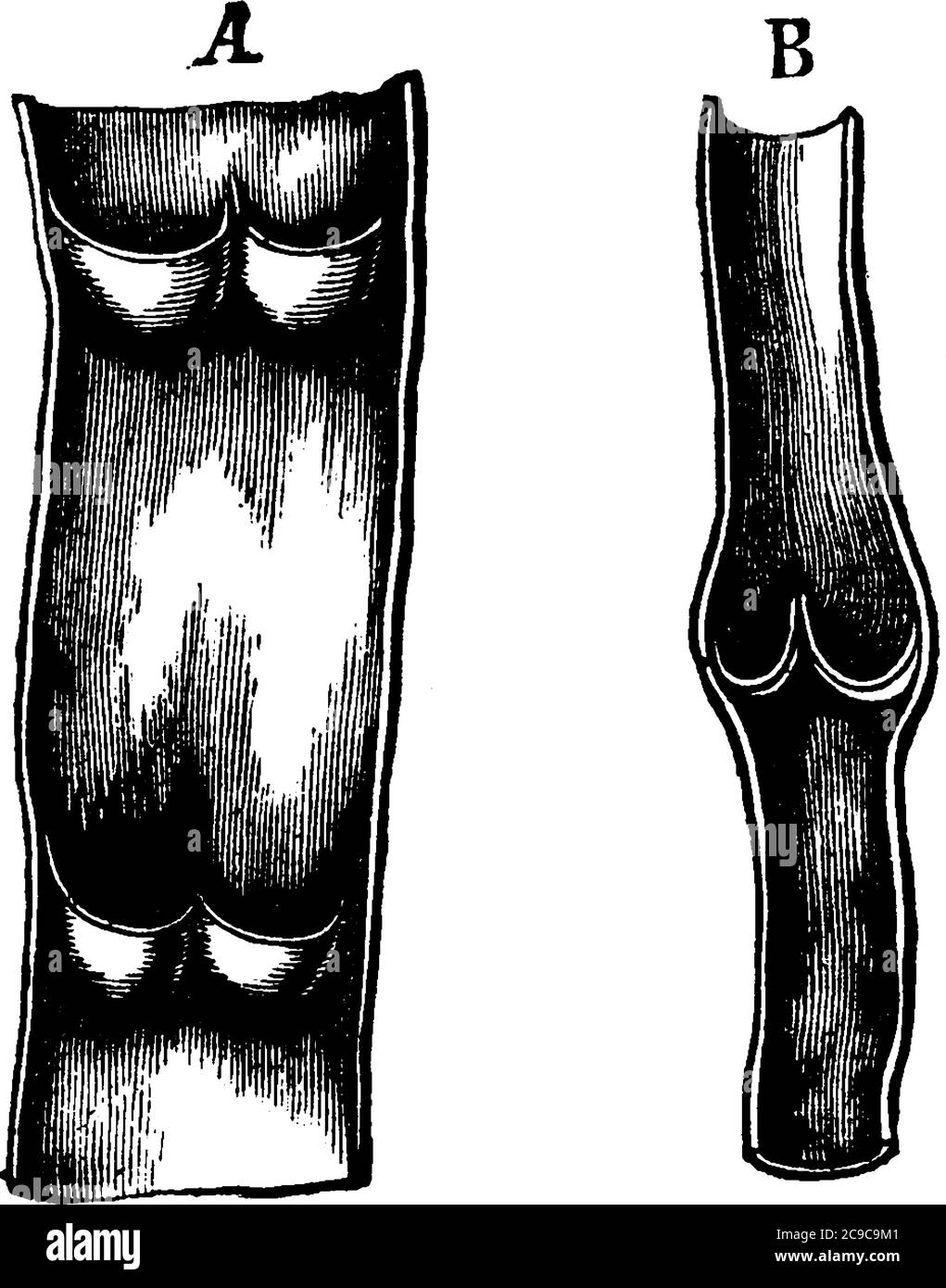 Structure of a vein with valves. 'A and B', representing the part of a ...