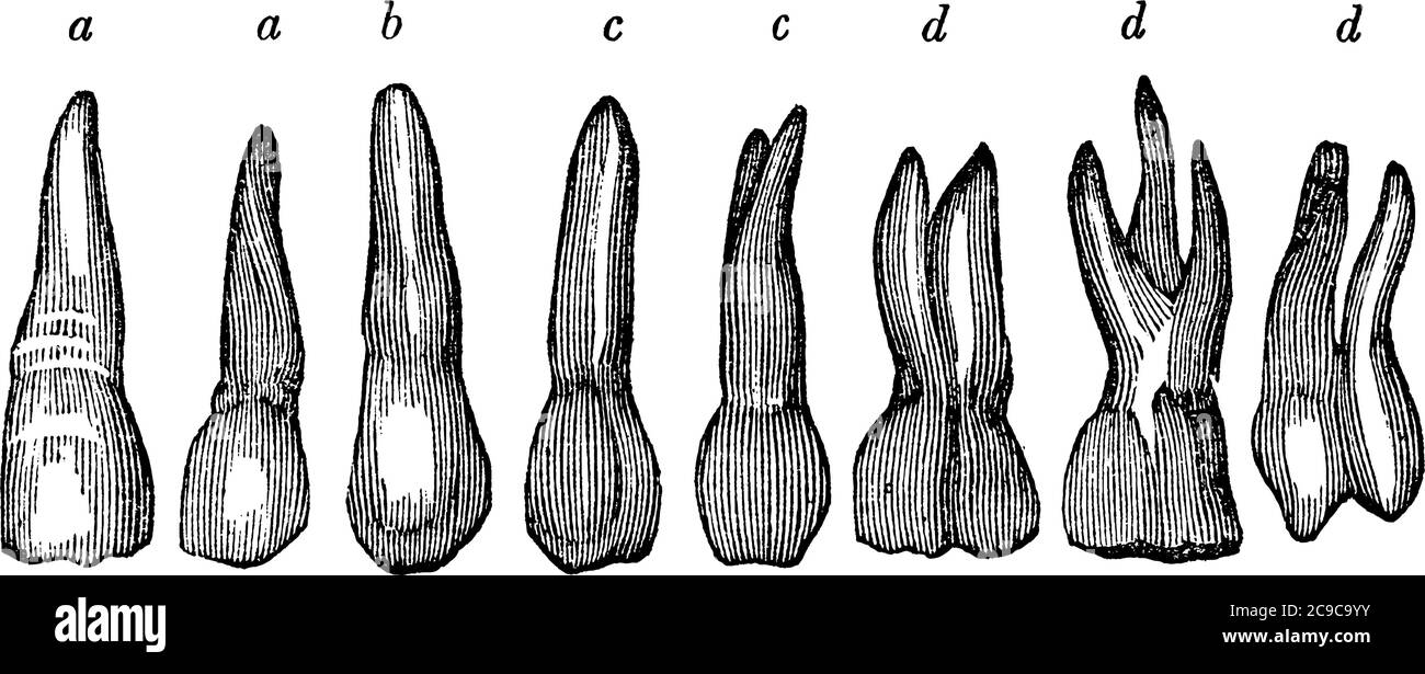 Upper jaw front Stock Vector Images - Alamy