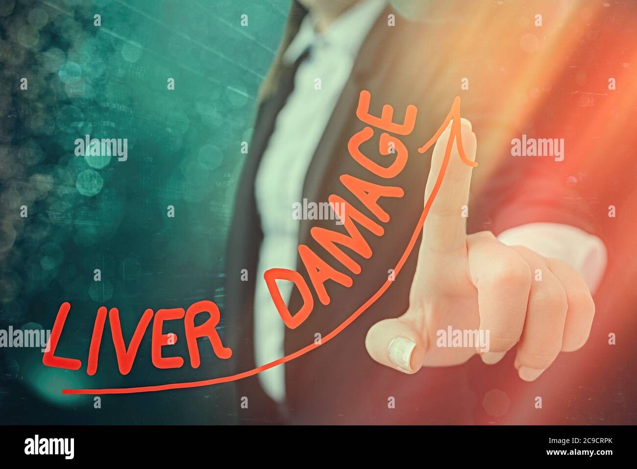 Handwriting text writing Liver Damage. Conceptual photo any disorder of ...