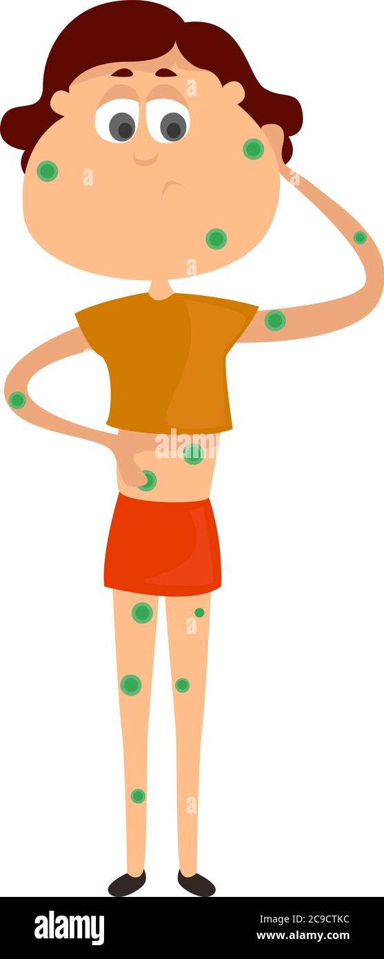 Girl with chickenpox, illustration, vector on white background Stock ...