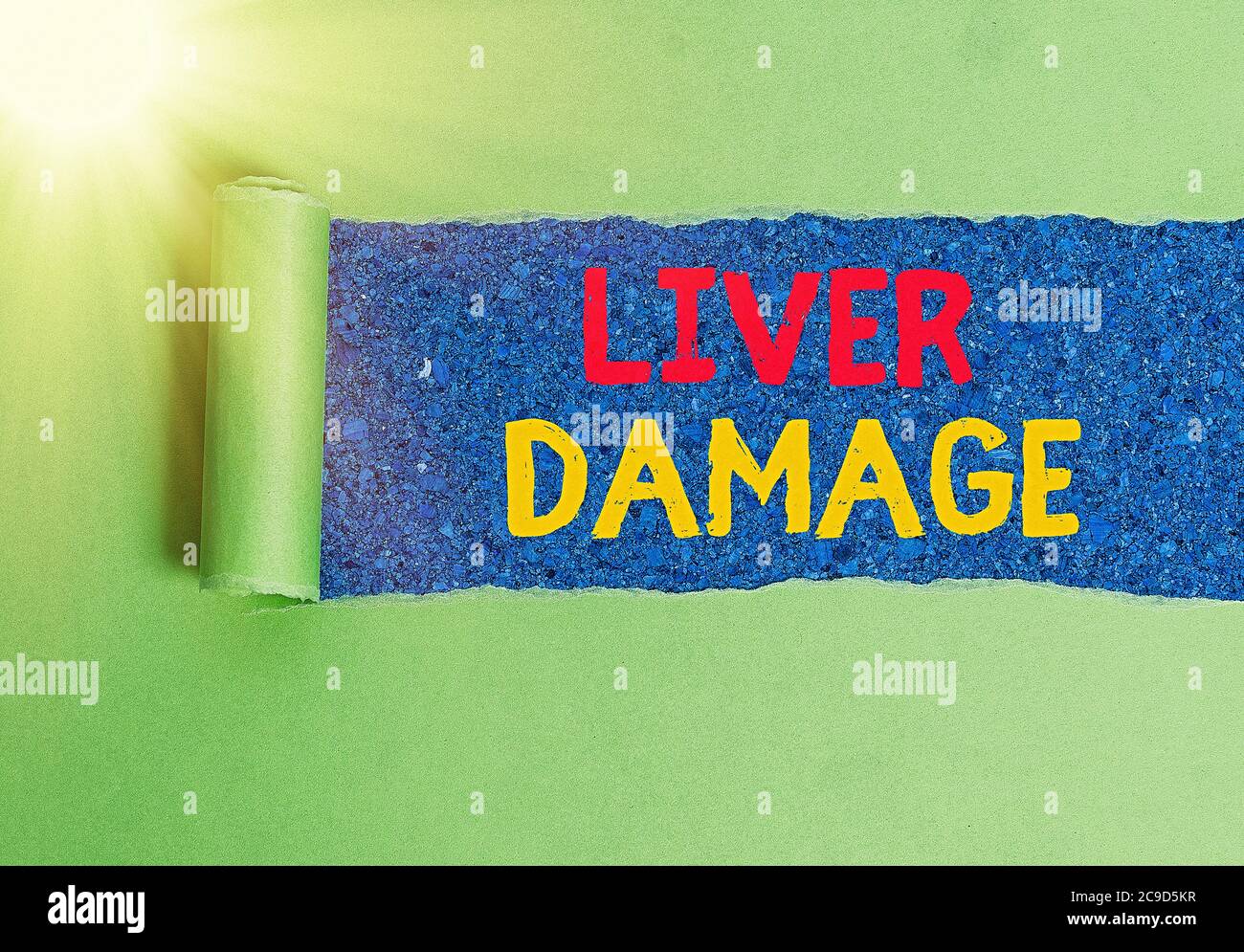 Handwriting text Liver Damage. Conceptual photo any disorder of the ...