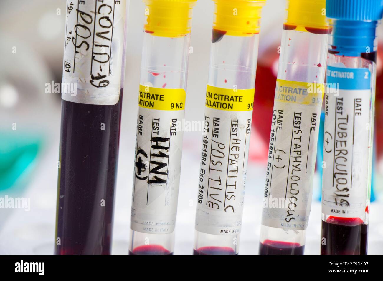 H1N1, Covid-19, Hepatitis C, Tuberculosis and Staphylococcus viruses ...