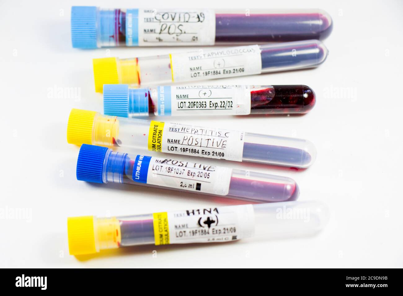 H1N1, Covid-19, Hepatitis C, Tuberculosis and Staphylococcus viruses ...