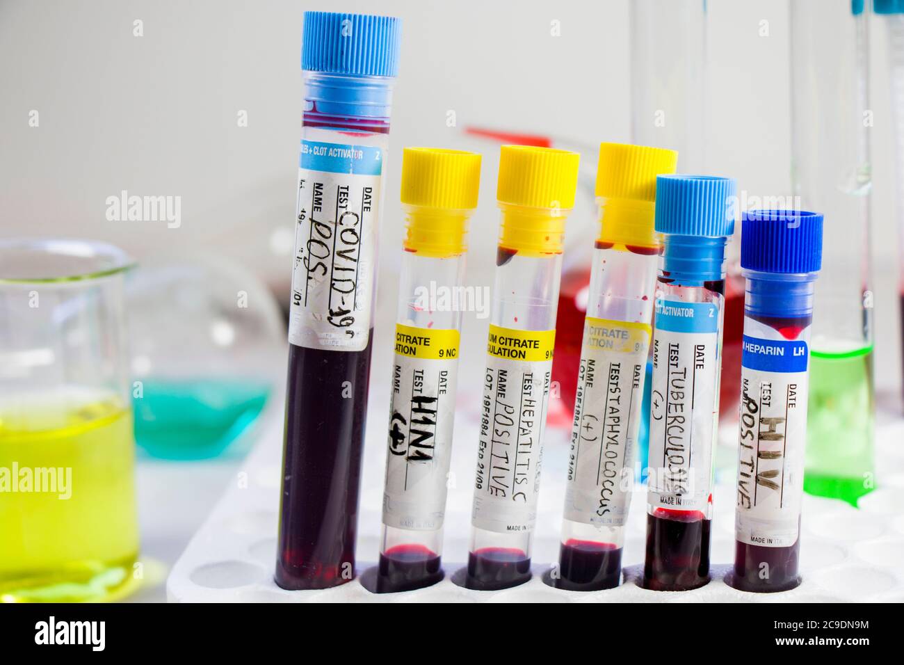 H1N1, Covid-19, Hepatitis C, Tuberculosis and Staphylococcus viruses ...