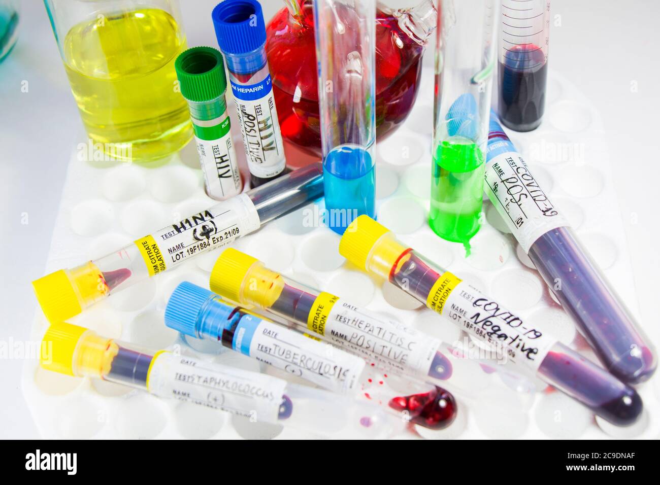 H1N1, Covid-19, Hepatitis C, Tuberculosis and Staphylococcus viruses ...