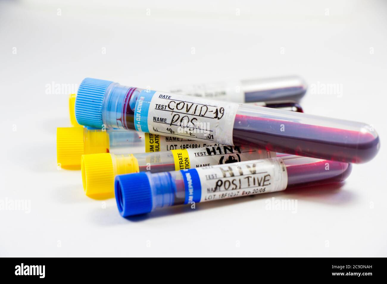 H1N1, Covid-19, Hepatitis C, Tuberculosis and Staphylococcus viruses ...