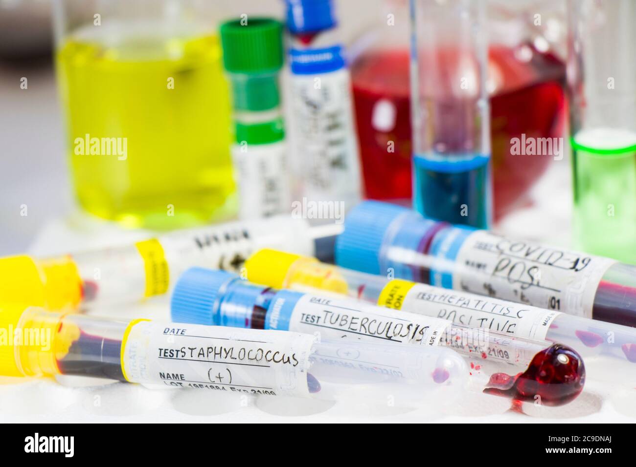 H1N1, Covid-19, Hepatitis C, Tuberculosis and Staphylococcus viruses ...