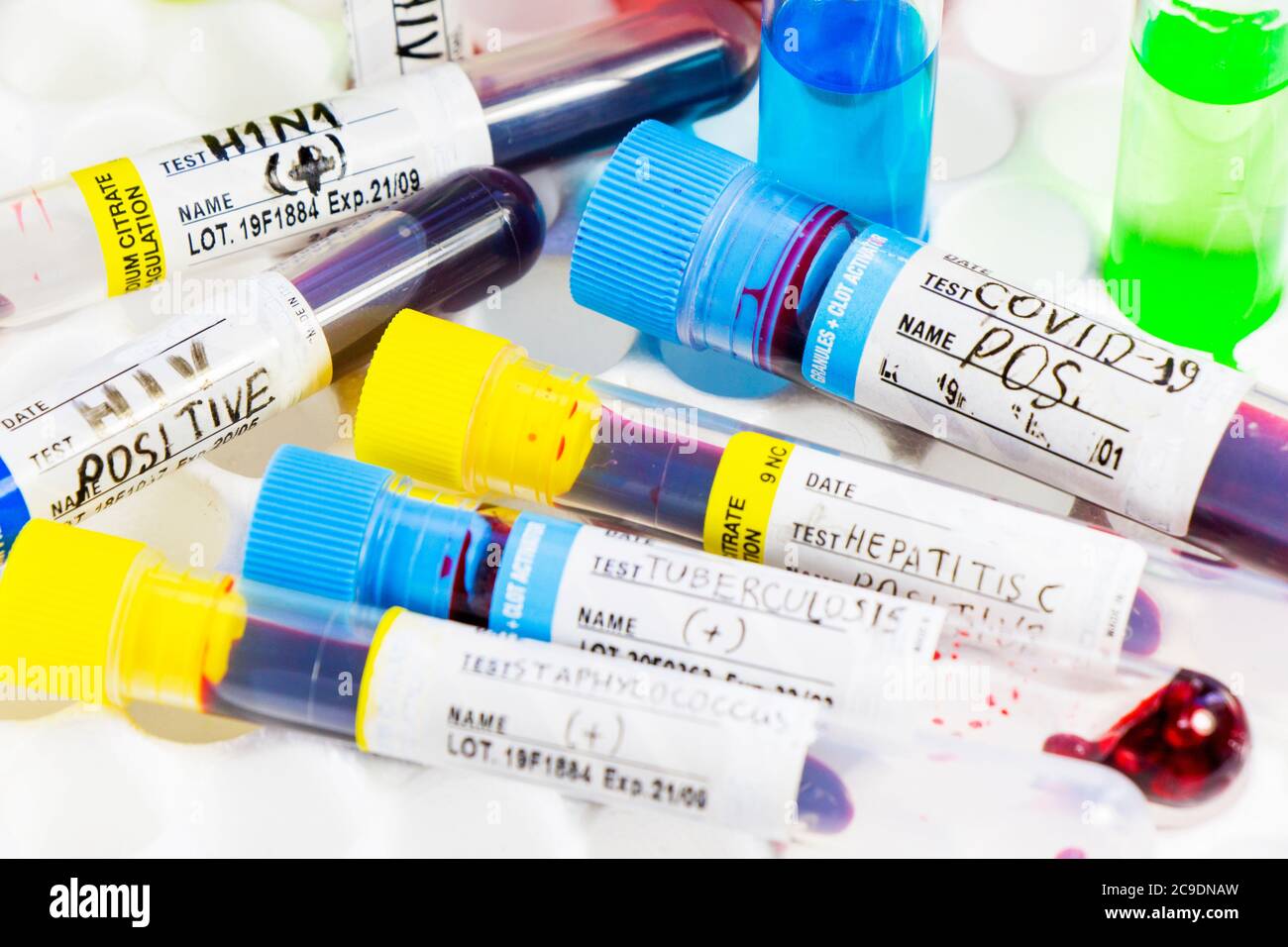 H1N1, Covid-19, Hepatitis C, Tuberculosis and Staphylococcus viruses ...