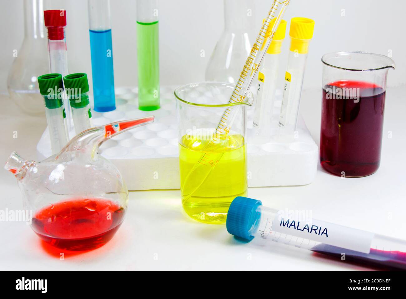 Malaria blood test tube samples, laboratory and diagnoses, chemical ...