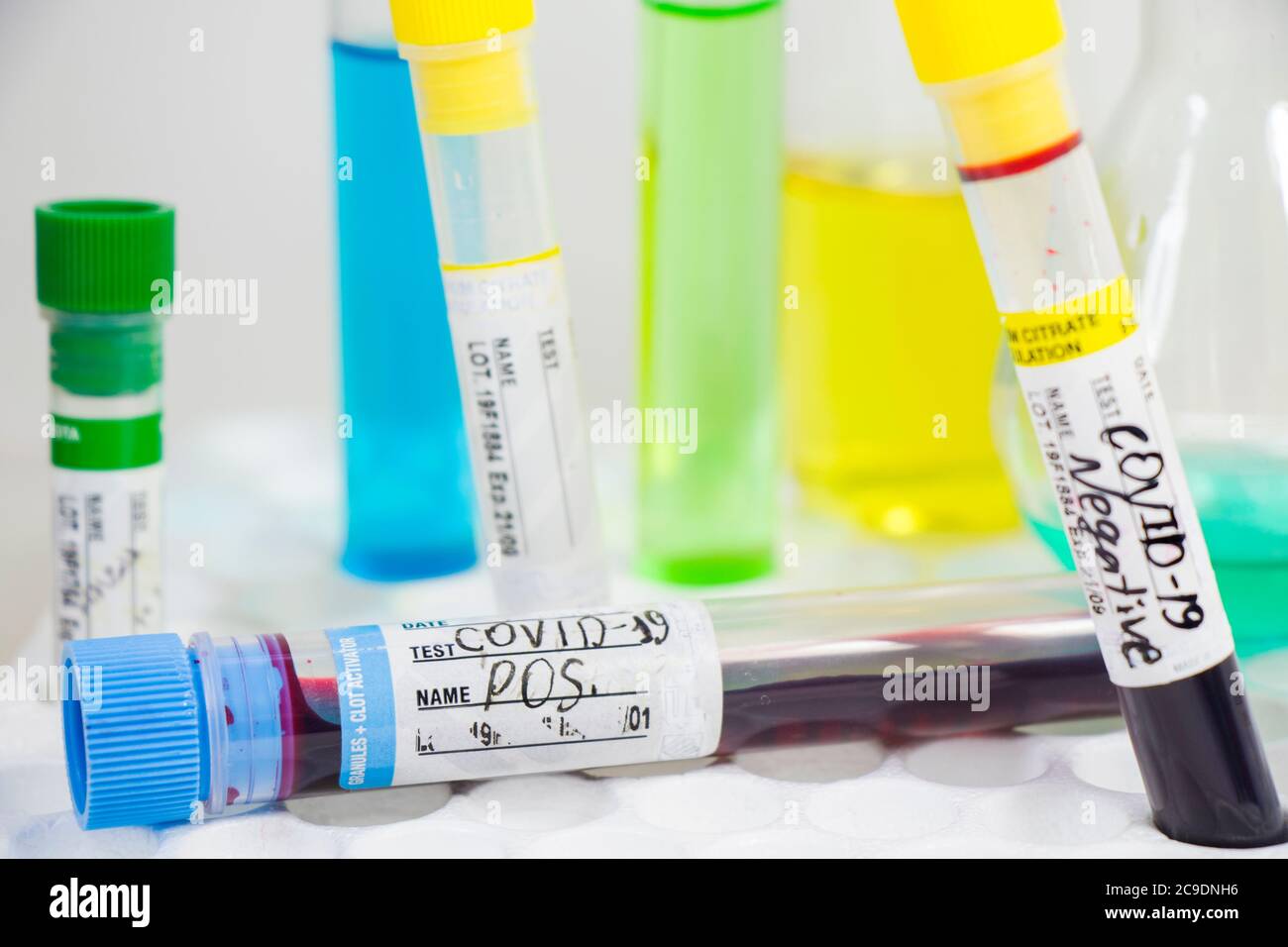 Corona virus and Covid-19 positive blood test tubes on the white ...