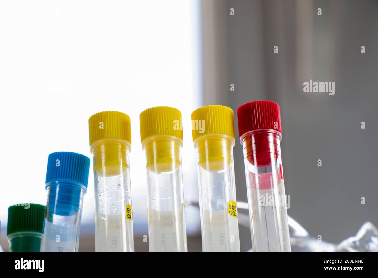 Laboratory blood test tube samples, research diagnoses, instruments and ...