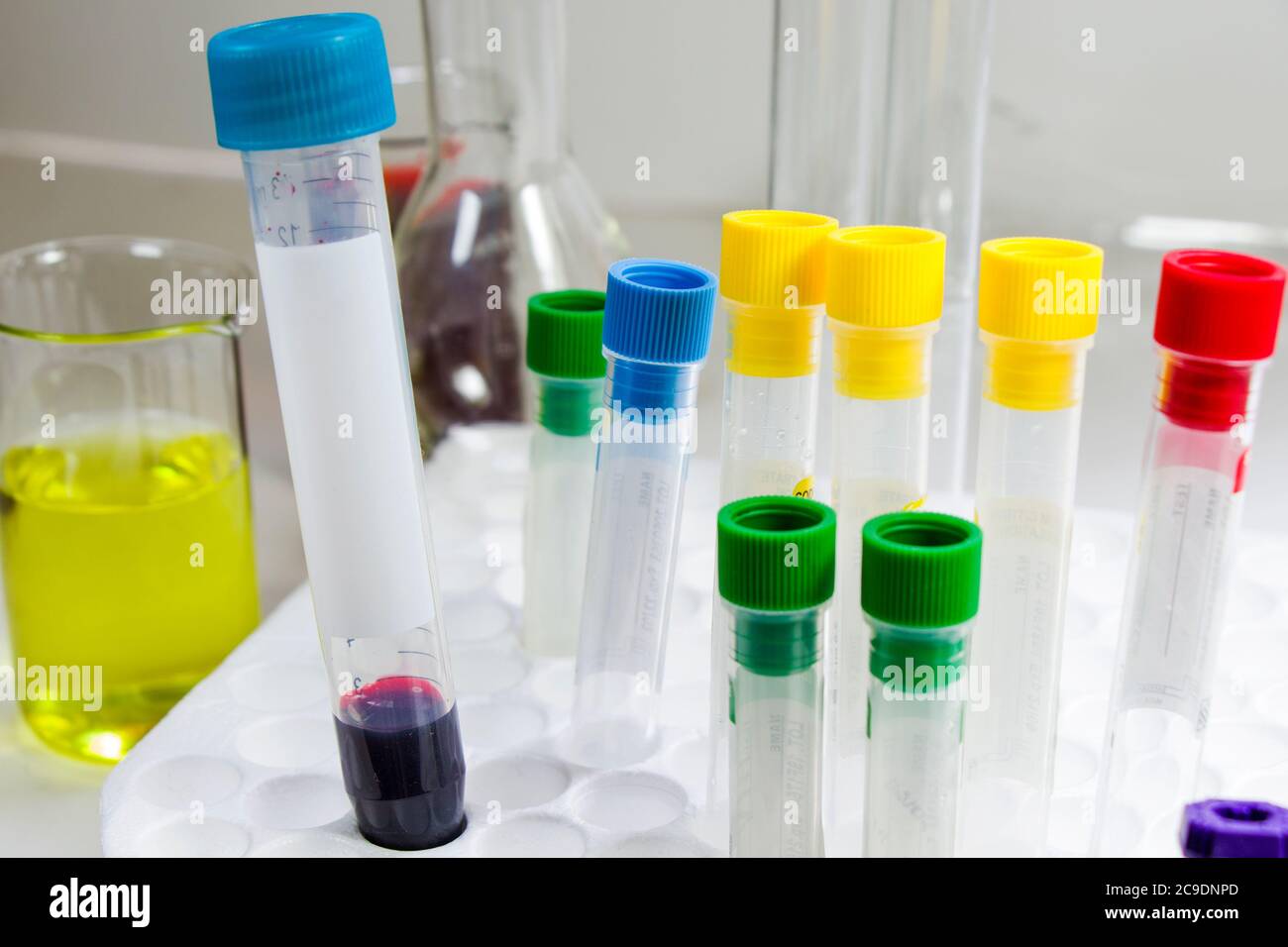 Laboratory blood test tube samples, research diagnoses, instruments and ...