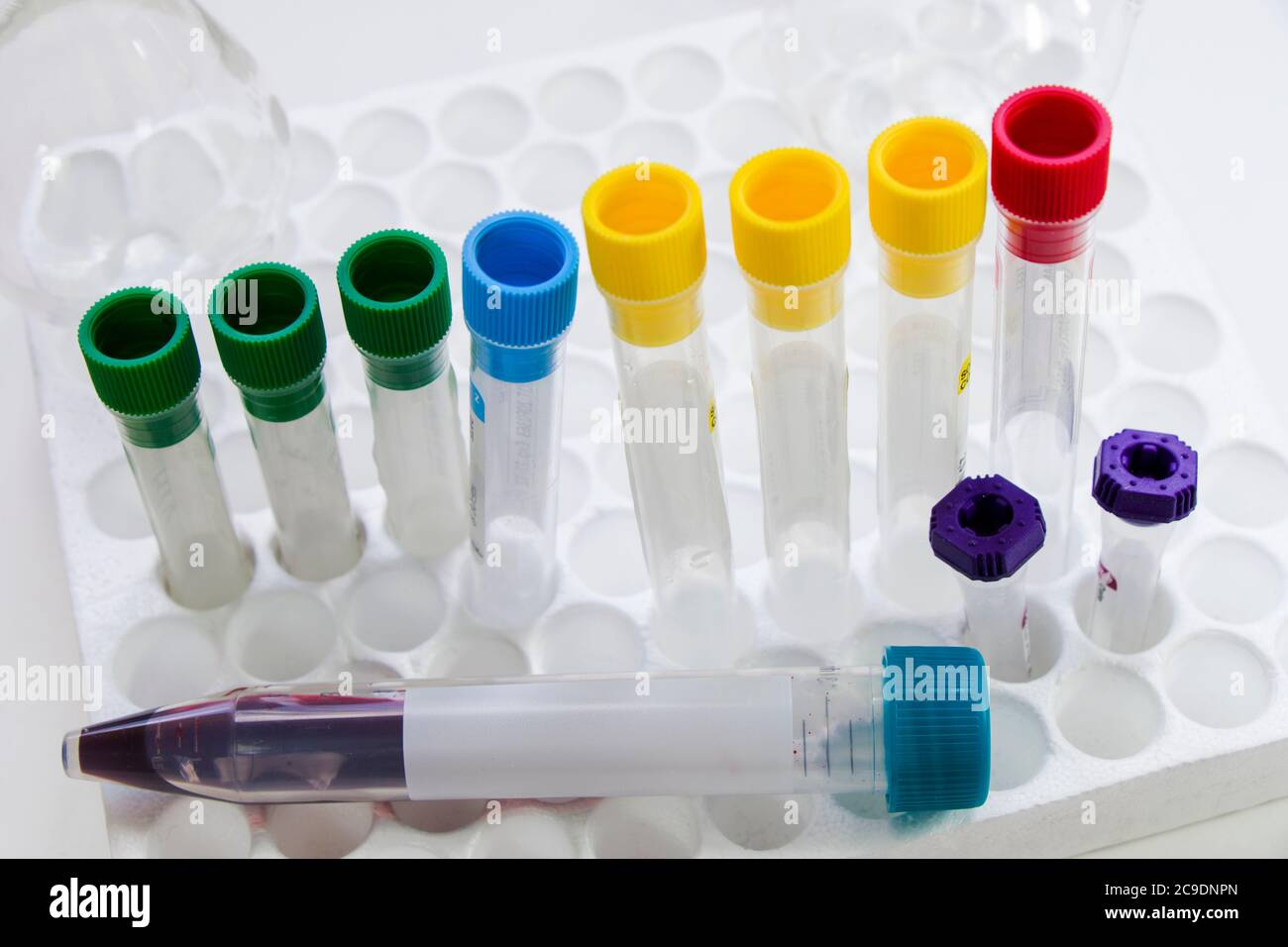 Laboratory blood test tube samples, research diagnoses, instruments and ...