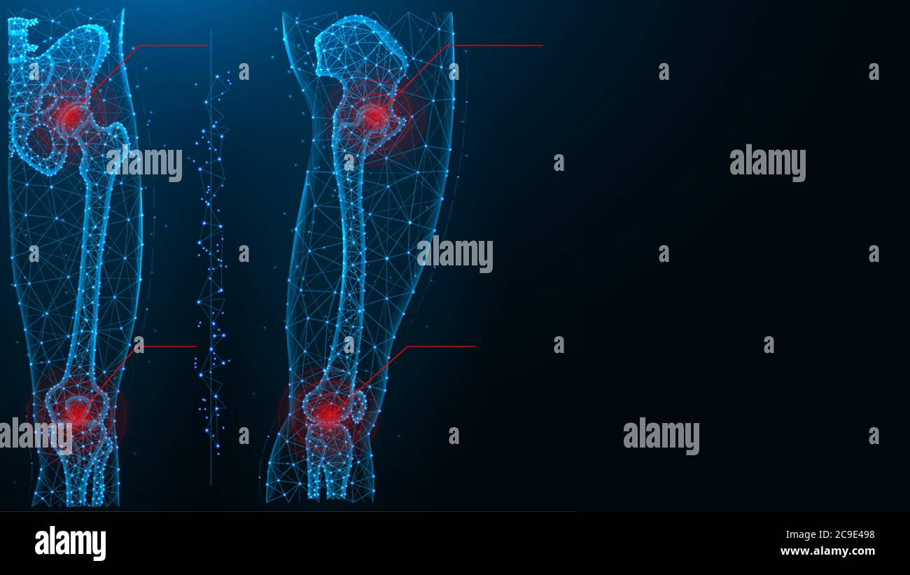 Pain in the hip and knee joint blue polygonal vector illustration Stock ...