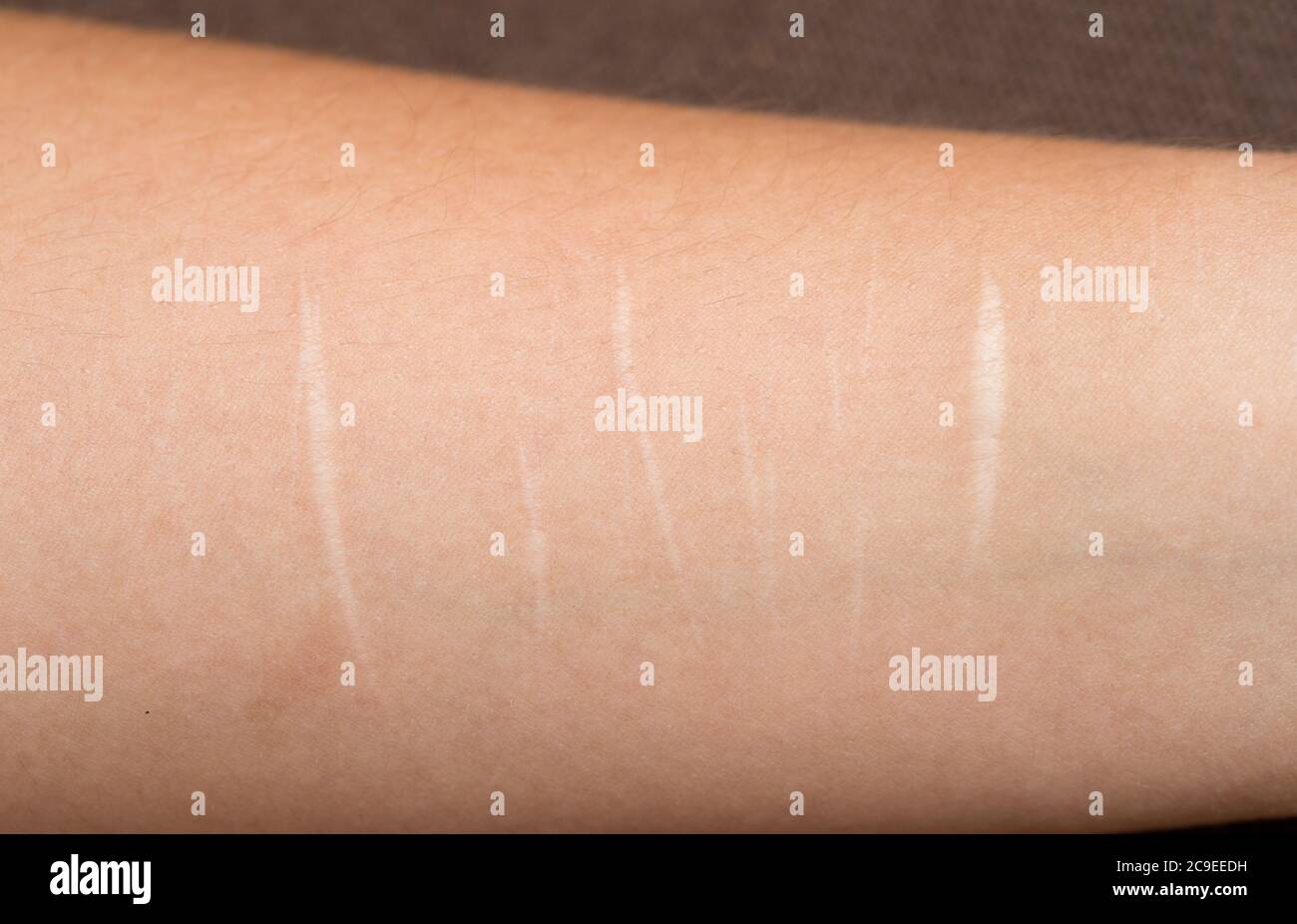 Hand with cuts after suicide attempt Stock Photo - Alamy