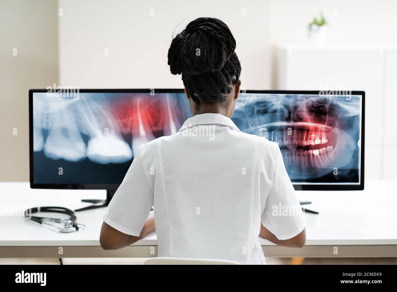 Dentist Doctor Looking At Teeth Xray Using Computer Software Stock ...