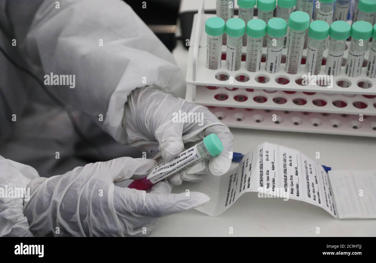 Breath sample hi-res stock photography and images - Alamy