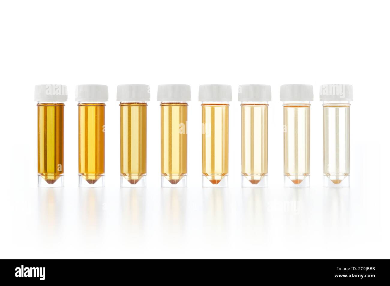Urine samples for analysis, studio shot Stock Photo - Alamy