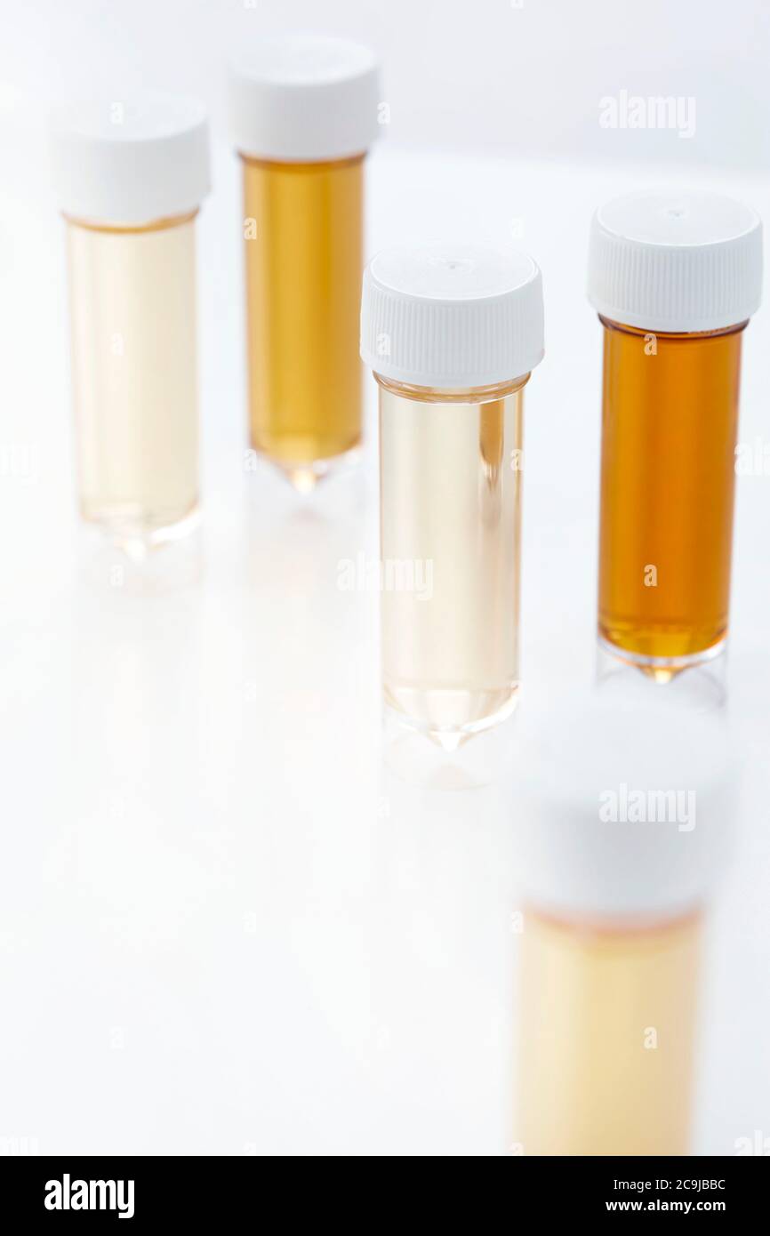 Urine samples for analysis, studio shot Stock Photo - Alamy