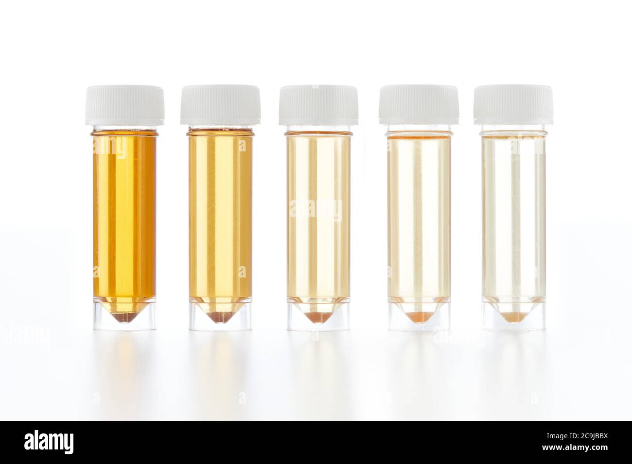 Urine samples for analysis, studio shot Stock Photo - Alamy