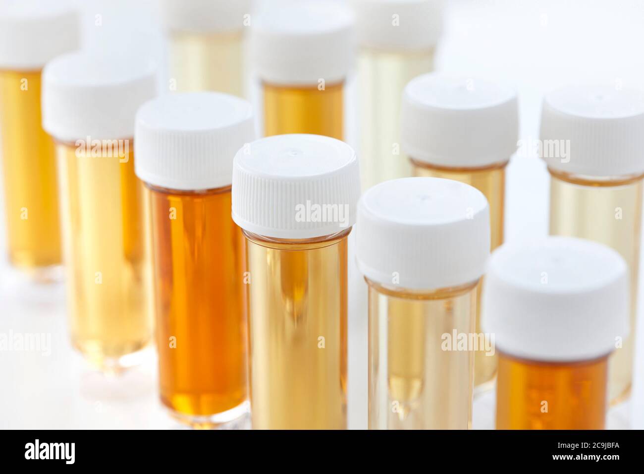 Urine samples for analysis, studio shot Stock Photo - Alamy