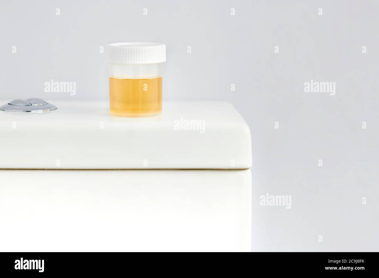 Urine sample on toilet, studio shot Stock Photo - Alamy