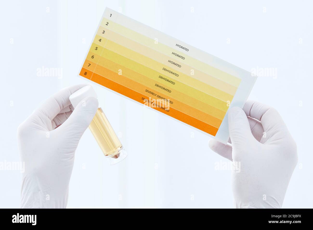 Urine sample in container and chart, studio shot Stock Photo - Alamy