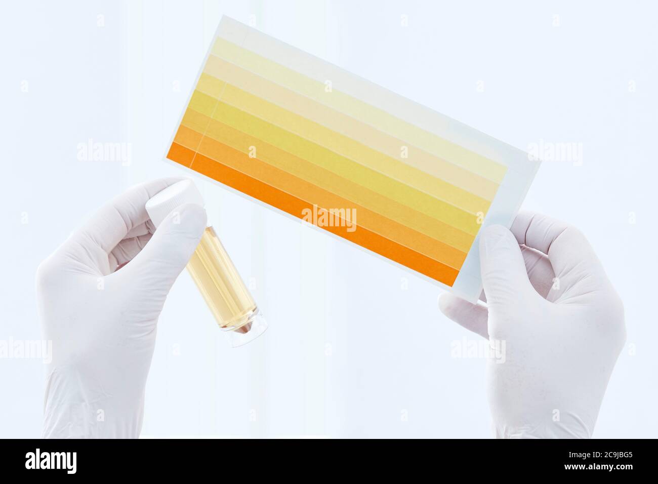 Urine sample in container and chart, studio shot Stock Photo - Alamy