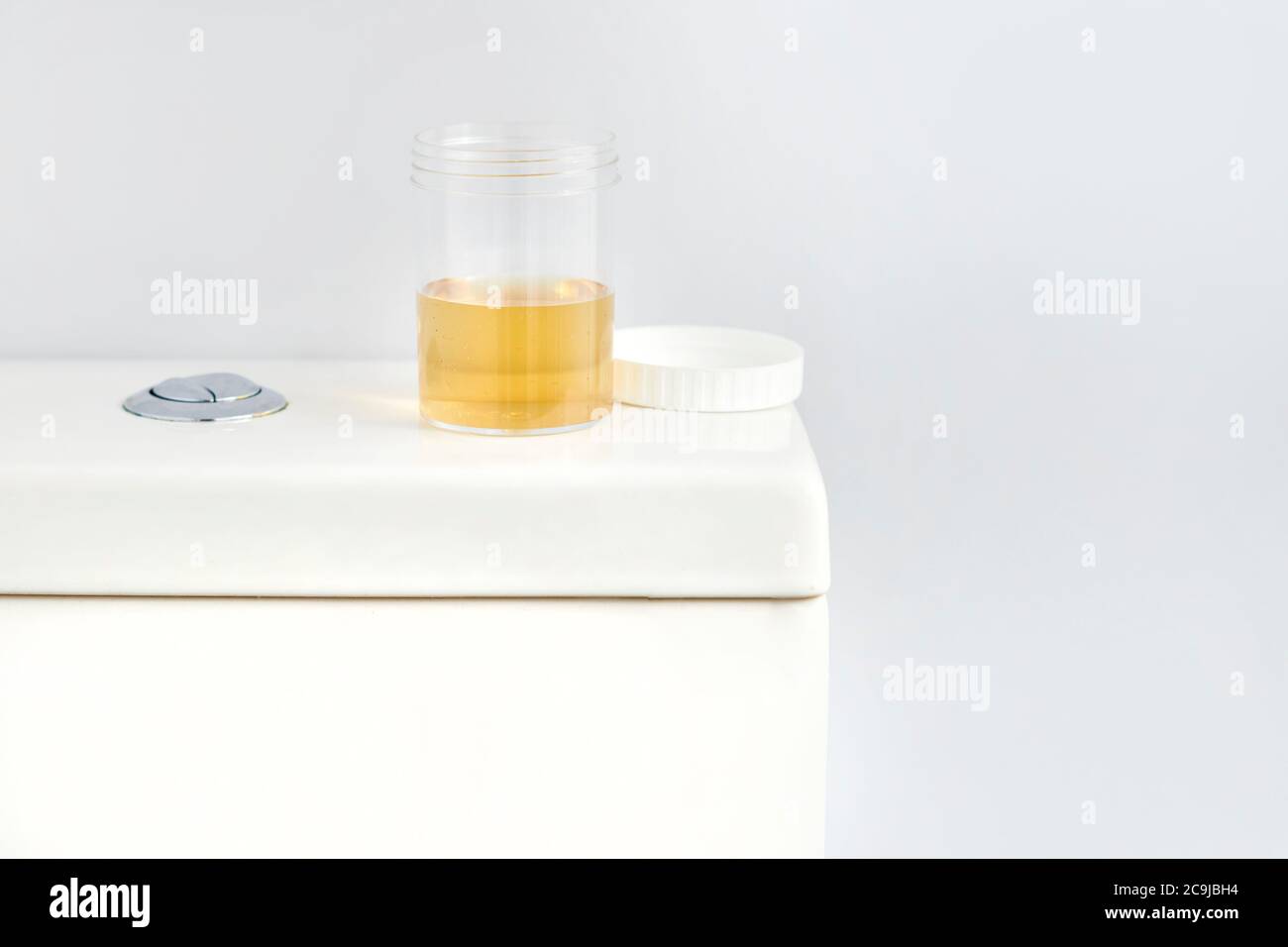 Urine sample on toilet, studio shot Stock Photo - Alamy
