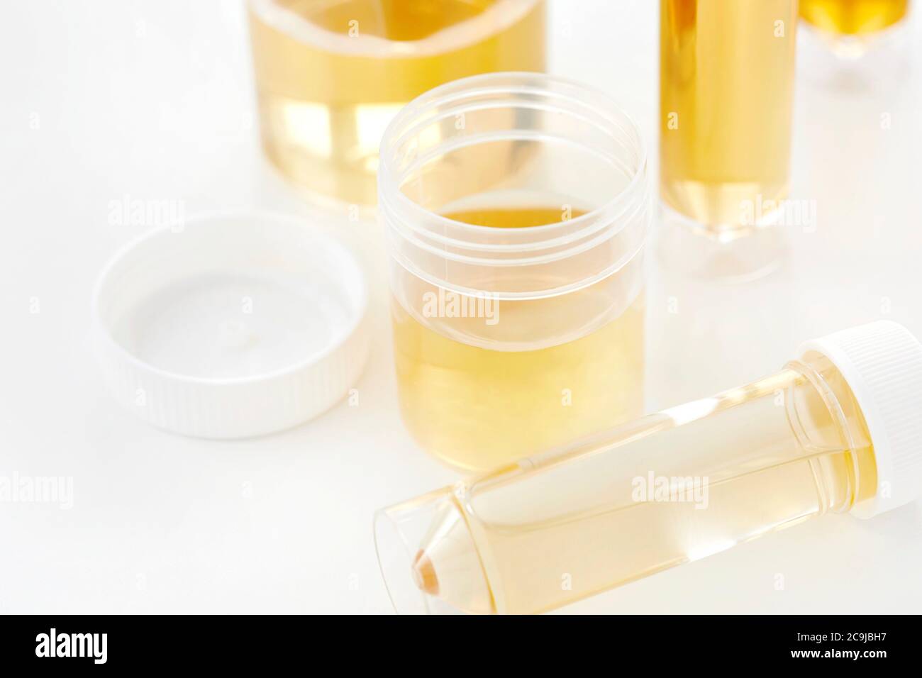 Urine samples for analysis, studio shot Stock Photo - Alamy
