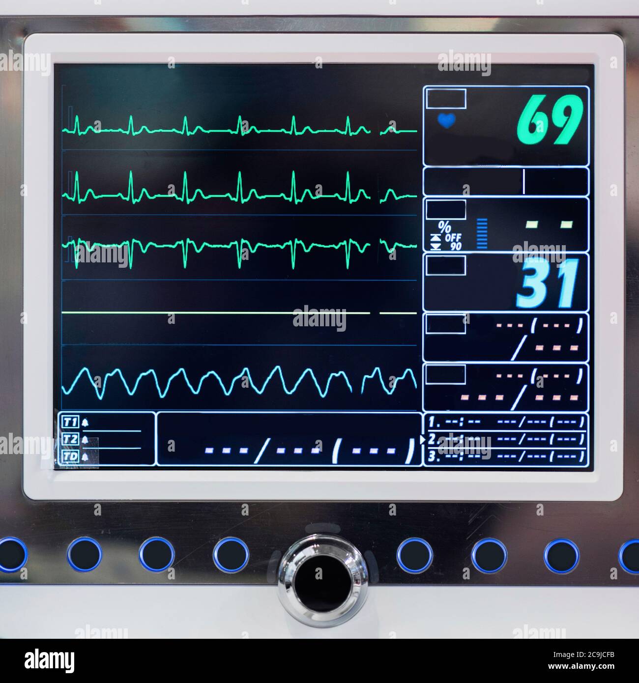 Vital signs monitor Stock Photo - Alamy