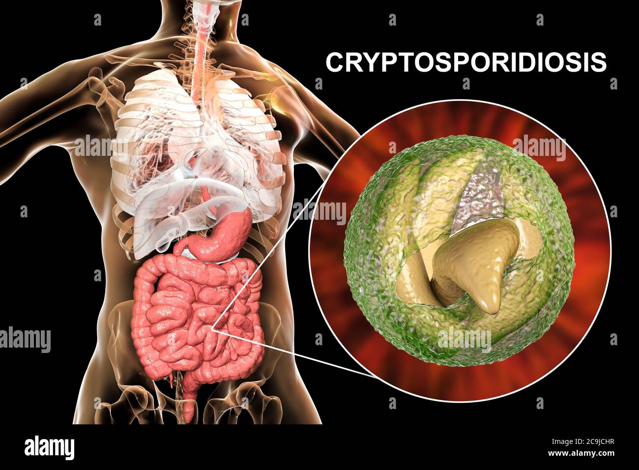 Cryptosporidium parvum parasites, the cause of cryptosporidiosis ...