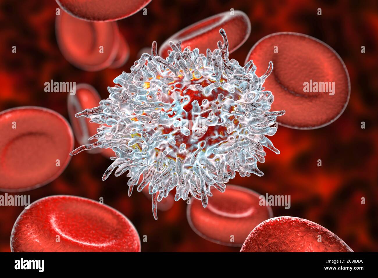 Hairy cell leukaemia. Computer illustration of an abnormal white blood ...