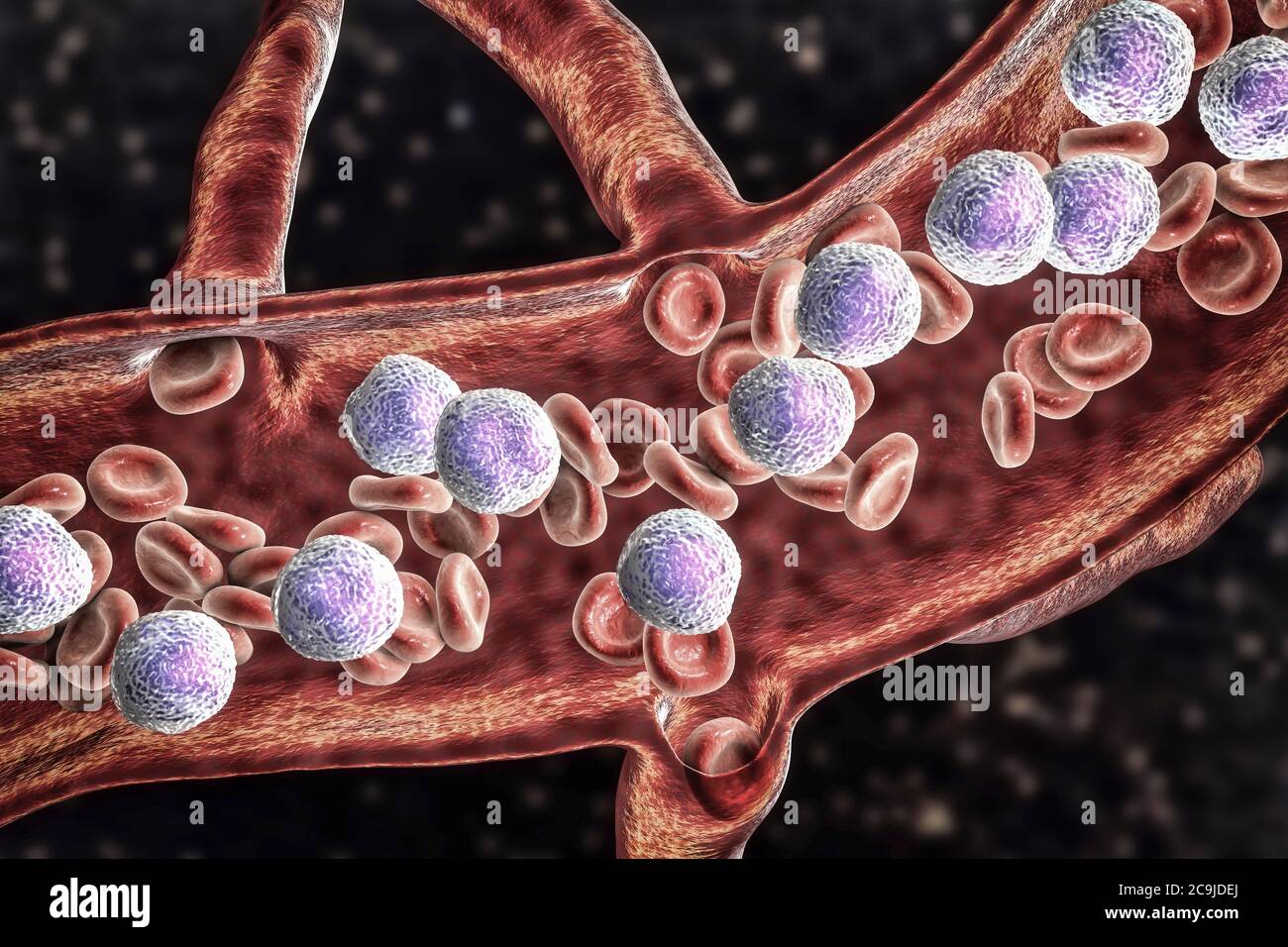 Computer illustration of a cross-section of blood vessel from a patient ...