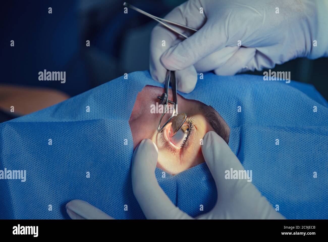 Eye surgery hi-res stock photography and images - Alamy