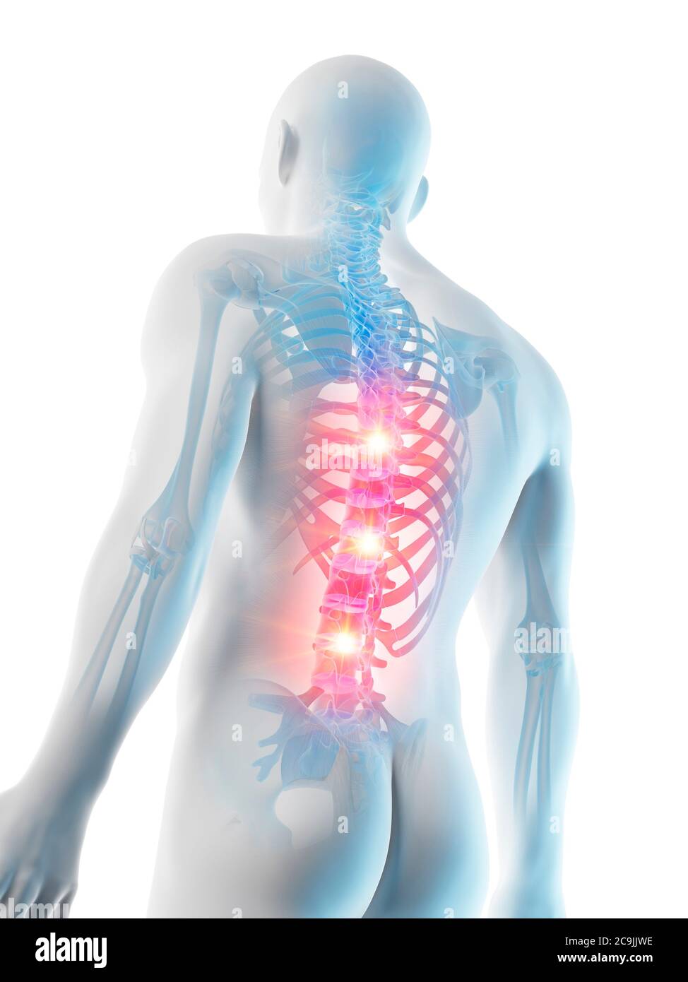 Back pain, conceptual computer illustration Stock Photo - Alamy