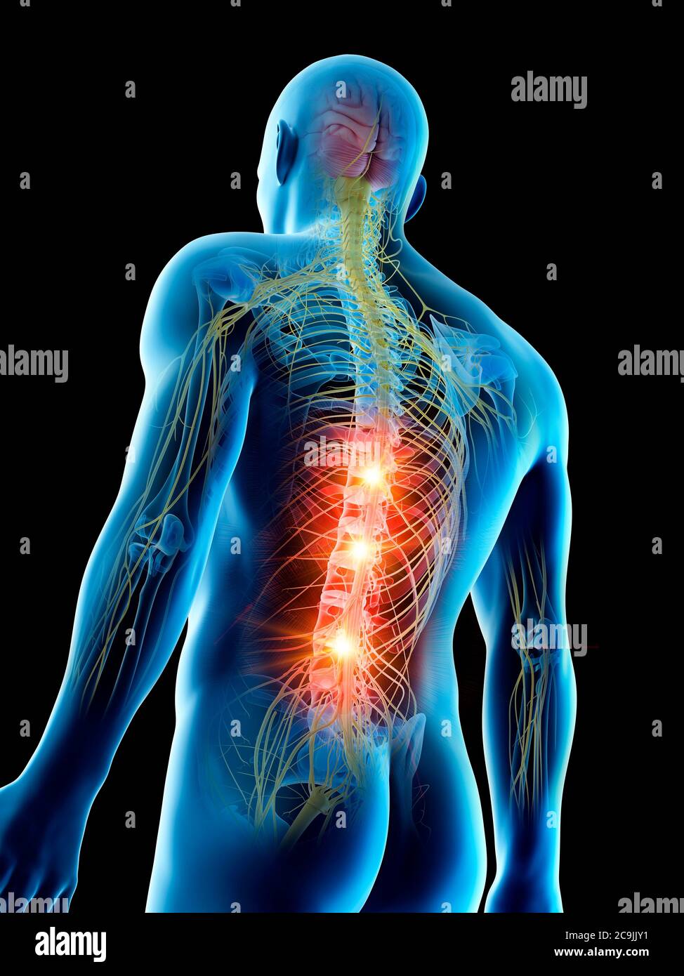 Back pain, conceptual computer illustration Stock Photo - Alamy
